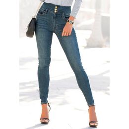 Lascana High-waist-Jeans mit goldfarbenen Knöpfen, blau