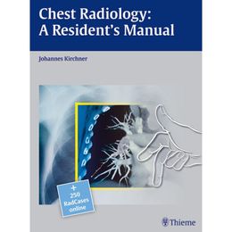 Chest Radiology - Johannes Kirchner, Gebunden