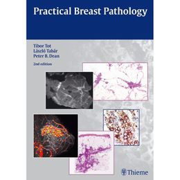Practical Breast Pathology - Tibor Tot, Laszlo Tabar, Peter B. Dean, Gebunden