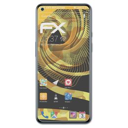 atFoliX Schutzfolie für OnePlus 9, (3 Folien), Entspiegelnd und stoßdämpfend, weiß