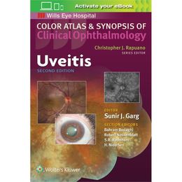 Uveitis (Color Atlas and Synopsis of Clinical Ophthalmology) - Sunir Garg, Kartoniert (TB)