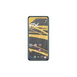 atFoliX Schutzfolie für Xiaomi Poco X3