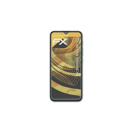 atFoliX Schutzfolie für Motorola Moto G9 Play