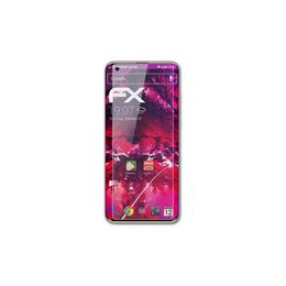 atFoliX Schutzfolie Panzerglasfolie für Xiaomi Mi 10
