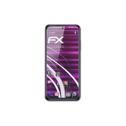 atFoliX Schutzfolie Panzerglasfolie für Xiaomi Redmi Note 10S