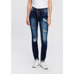 Arizona Slim-fit-Jeans mit sichtbarer, schräger Knopfleiste Mid Waist, blau