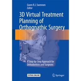 Springer Berlin Heidelberg 3D Virtual Treatment Planning of Orthognathic Surgery - Gwen Swennen, Gebunden