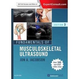 Fundamentals of Musculoskeletal Ultrasound - Jon A. Jacobson, Kartoniert (TB)