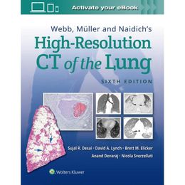 Webb, Muller and Naidich's High Resolution of Lung CT - Sujal Desai, David A. Lynch, Brett M. Elicker, Anand Devaraj, Nicola Sverzellati, Gebunden