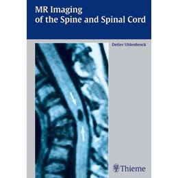 MR Imaging of the Spine and Spinal Cord - Detlev Uhlenbrock, Gebunden