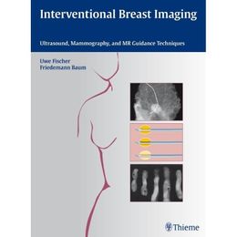 Interventional Breast Imaging - Uwe Fischer, Friedemann Baum, Gebunden