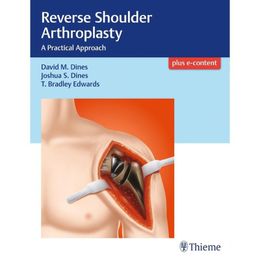 Reverse Shoulder Arthroplasty - David M. Dines, Joshua Dines, T Bradley Edwards, Gebunden
