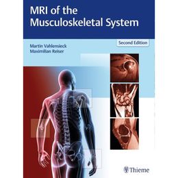 MRI of the Musculoskeletal System, Gebunden