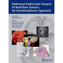 Endonasal Endoscopic Surgery of Skull Base Tumors - Wolfgang Draf, Ricardo L. Carrau, Ulrike Bockmühl, Amin B. Kassam, Peter Vajkoczy, Gebunden