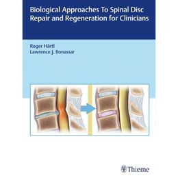 Biological Approaches to Spinal Disc Repair and Regeneration for Clinicians, Gebunden