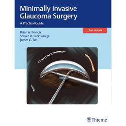 Minimally Invasive Glaucoma Surgery - Brian Francis, Steven Sarkisian, James C. Tan, Gebunden