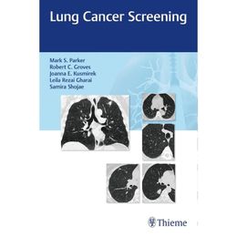 Lung Cancer Screening - Mark Parker, Robert Groves, Joanna Kusmirek, Kartoniert (TB)
