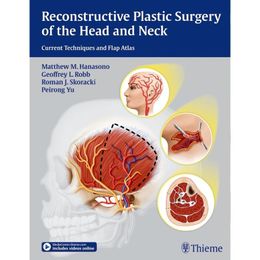 Reconstructive Plastic Surgery of the Head and Neck - Matthew M. Hanasono, Geoffrey L. Robb, Roman J. Skoracki, Peirong Yu, Gebunden