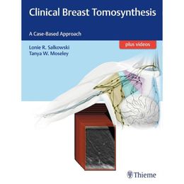 Clinical Breast Tomosynthesis - Lonie R. Salkowski, Tanya Moseley, Gebunden
