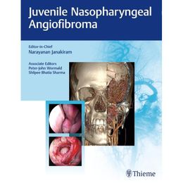 Juvenile Nasopharyngeal Angiofibroma, Gebunden