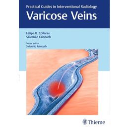 Varicose Veins: Practical Guides in Interventional Radiology - Felipe Collares, Salomao Faintuch, Kartoniert (TB)