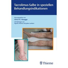 Tacrolimus-Salbe in speziellen Behandlungsindikationen, Kartoniert (TB)