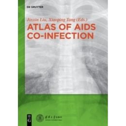 De Gruyter Atlas of AIDS Co-infection, Kartoniert (TB)