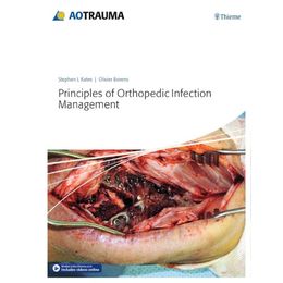 Principles of Orthopedic Infection Management - Stephen Kates, Olivier Borens, Gebunden