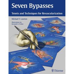 Seven Bypasses - Michael T. Lawton, Gebunden