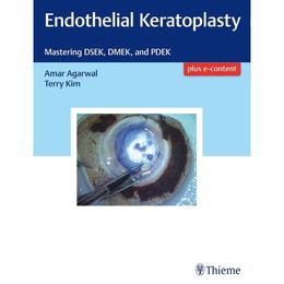 Endothelial Keratoplasty - Amar Agarwal, Terry Kim, Gebunden