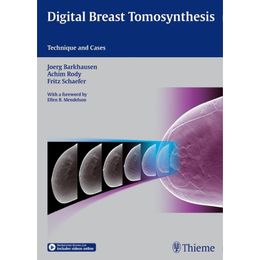 Digital Breast Tomosynthesis - Jörg Barkhausen, Joerg Barkhausen, Achim Rody, Fritz K.W. Schäfer, Gebunden