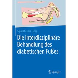 Springer Berlin Heidelberg Die interdisziplinäre Behandlung des diabetischen Fußes, Gebunden