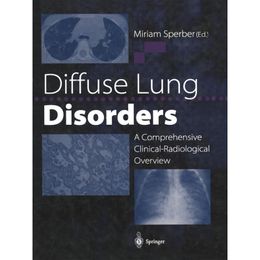 Springer Diffuse Lung Disorders, Kartoniert (TB)