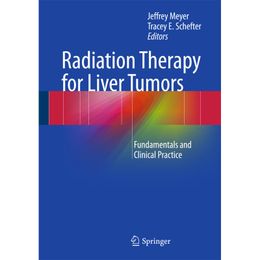 Springer Radiation Therapy for Liver Tumors, Kartoniert (TB)