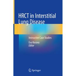 Springer International Publishing HRCT in Interstitial Lung Disease, Gebunden