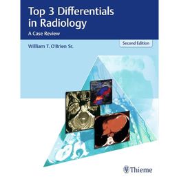 Top 3 Differentials in Radiology - William T. O'Brien, Kartoniert (TB)