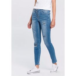 Arizona Slim-fit-Jeans mit sichtbarer, schräger Knopfleiste Mid Waist, blau