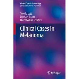 Springer International Publishing Clinical Cases in Melanoma, Kartoniert (TB)