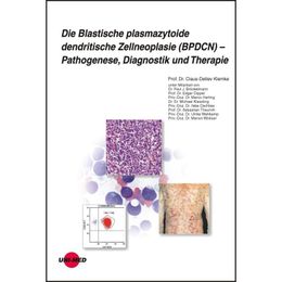 Die Blastische plasmazytoide dendritische Zellneoplasie (BPDCN) - Pathogenese, Diagnostik und Therapie - Claus-Detlev Klemke, Gebunden