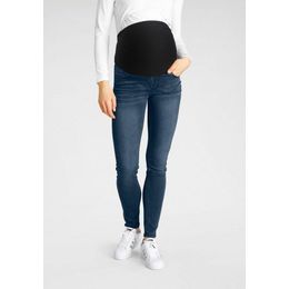 Neun Monate Umstandsjeans, Jeans für Schwangerschaft und Stillzeit, Umstandsjeans aus trendigem Jogg-Denim, blau