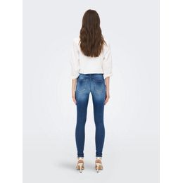 Only Skinny-fit-Jeans ROYAL (1-tlg) Plain/ohne Details