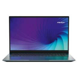 Medion® 173' Laptop S20 Ultra 5 125H (Md62629)