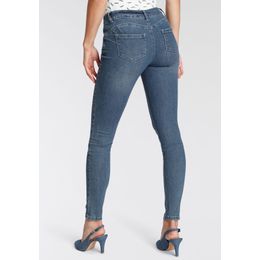 Skinny-fit-Jeans Arizona, Damen, Gr. 40, N-Gr, blau (blau, used), Denim/Jeans, Obermaterial: 69% Baumwolle, 30% Polyester, 1% Elasthan, Basic, skinny fit lang, Jeans, Recyceltes Polyester