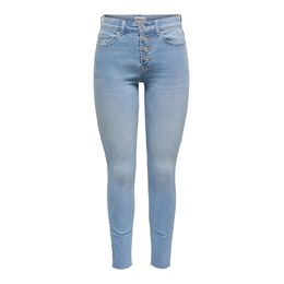 Only Jeans 'ONLMia' Damen Gr&ouml;&szlig;e 27/28 hellblau