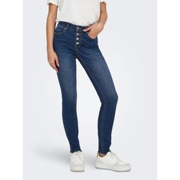 Skinny-fit-Jeans Only "ONLMIA MID WAIST BUTTON SK RW ANK BOX", Damen, Gr. XL (42), Länge 30, blau (dunkelblau denim), Denim/Jeans, Obermaterial: 92% Baumwolle, 5% Polyester, 3% Elasthan, unifarben, modisch, skinny fit knöchellang, Jeans