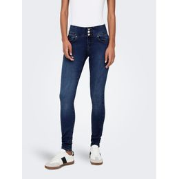 Only Damen Skinny-fit-Jeans "ONLROYAL REG VIS BUT SK DNM PIM", blau, Gr. M, unifarben, Denim/Jeans, Obermaterial: 69% Baumwolle, 29% Polyester, 2%