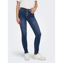 Only Skinny-fit-Jeans »ONLMIA MID WAIST BUTTON SK RW ANK BOX« Dark Blue Denim M (38) - Länge 30 Länge 30 M (38) Knöchellange Jeans von Only