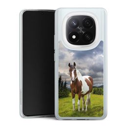 DeinDesign Xiaomi Redmi Note 14 Pro+ 5G Handy Silikon H&uuml;lle Case transparent Handyh&uuml;lle Meadow Nature Horse Silikon Case