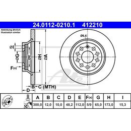 ATE Bremsensatz-Vorn und hinten SG00000DK2 Bremsensatz, Scheibenbremse vorne rechts links bel&uuml;ftet 300mm f&uuml;r SKODA SEAT VAG 5Q0698451L 1K0615301AA 7N0