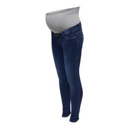 Only Maternity Umstandsjeans »OLMROYAL LIFE SK MBD JEANS DNM NOOS« Medium Blue Denim L (40) - Länge 32 Länge 32 L (40) Skinny Fit Umstandsjeans,...